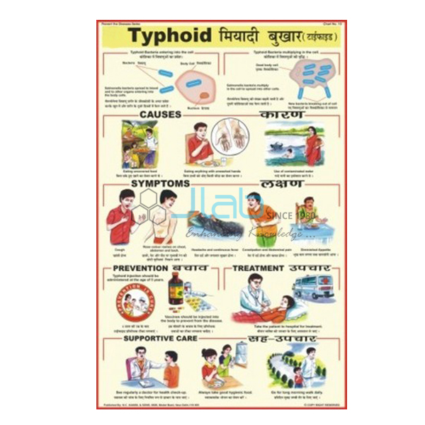 Typhoid Chart Manufacturers, Supplier & Exporters in India,Uruguay ...